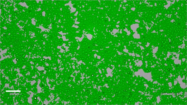 12Z Human Endometrial Epithelial Cell Line | SCC443